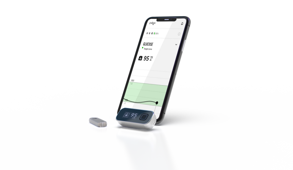 Indigo appoints Dr Arun Venkatasubramanian as Chief Technology Officer ...