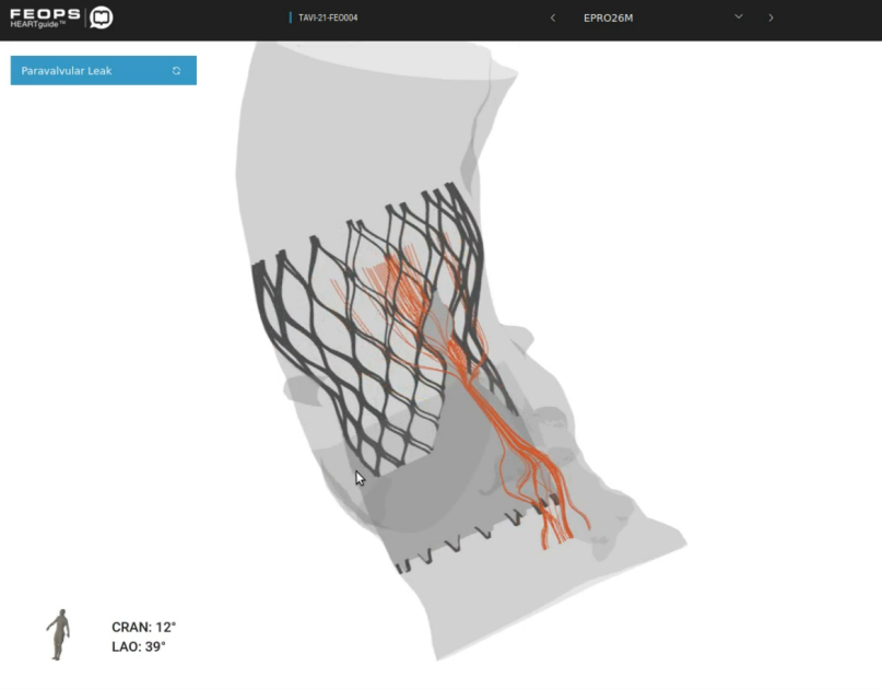 FEops appoints Digital Health expert Euan Thomson to its Board of ...