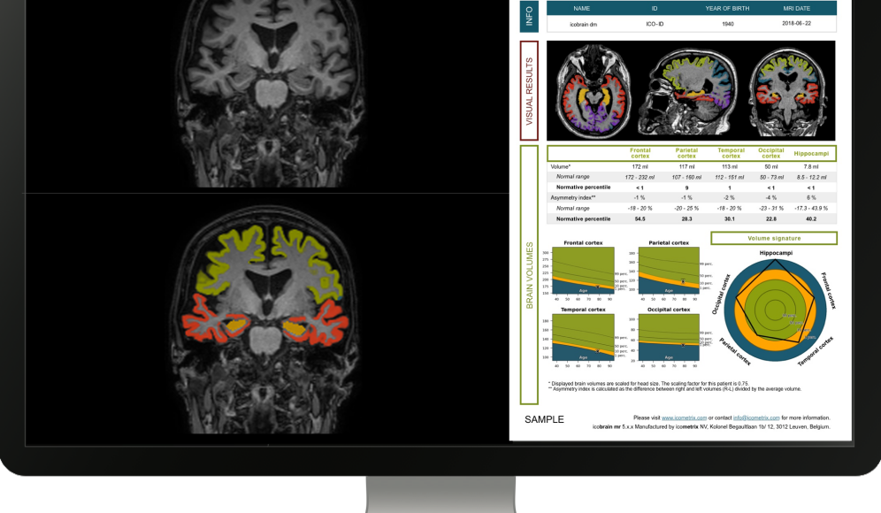 AMA issues CPT III code for icometrix’ AI-related brain MRI quantification software | Capricorn ...