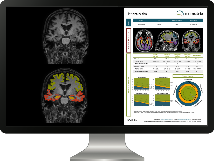Brain imaging AI leader icometrix raises US$ 18 million in new funding ...